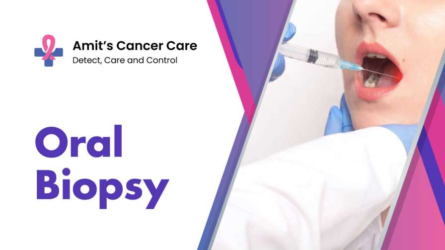 How To Perform An Oral Biopsy 
