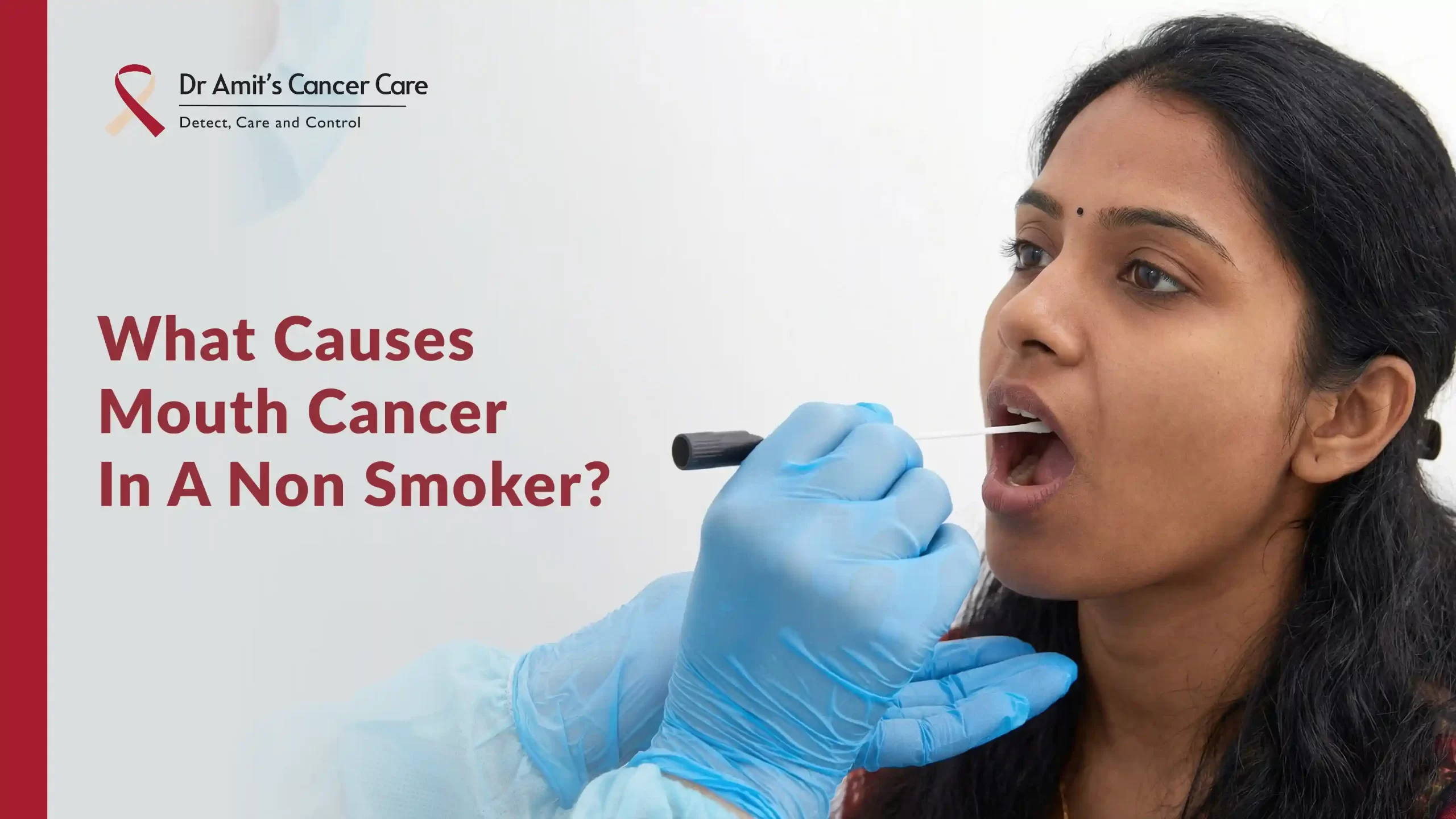 What causes mouth cancer in a non smoker?
