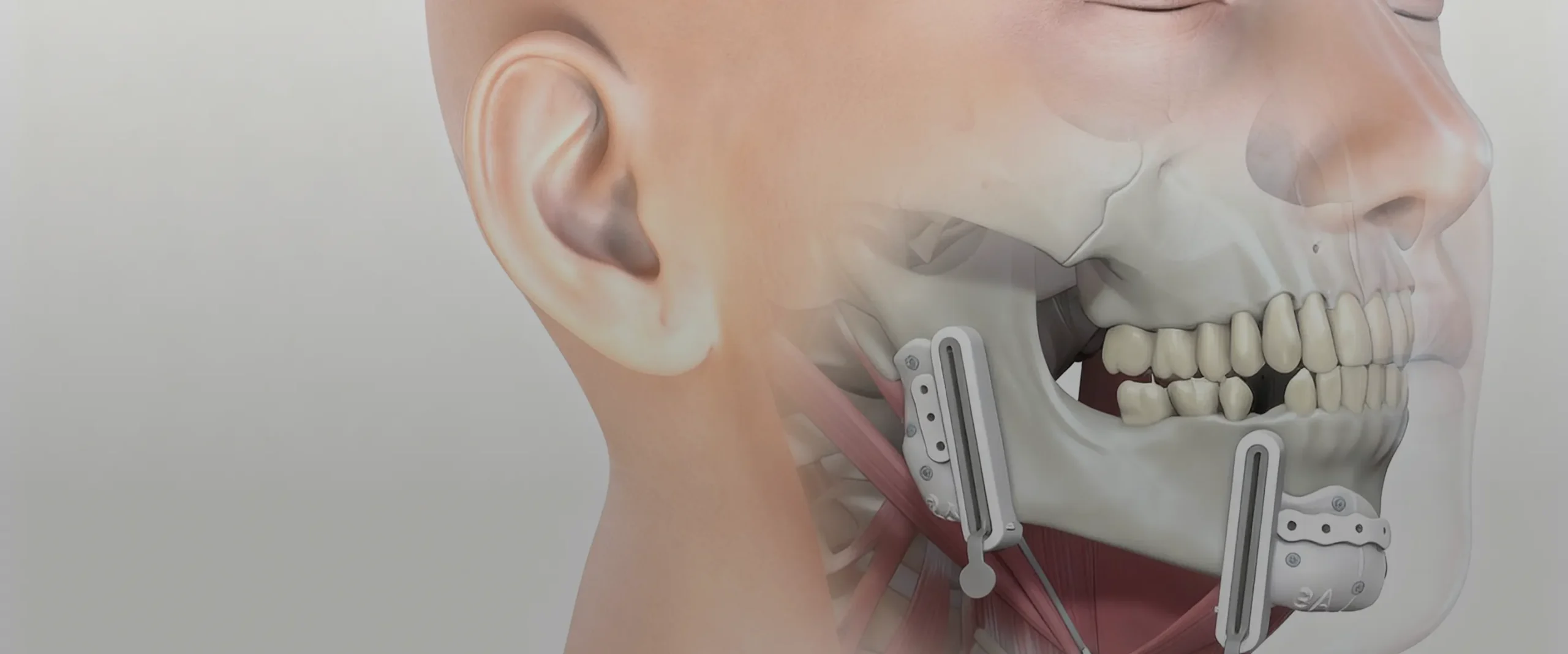 Mandibular Reconstruction in Mumbai | Jaw Reconstruction Surgery after ...